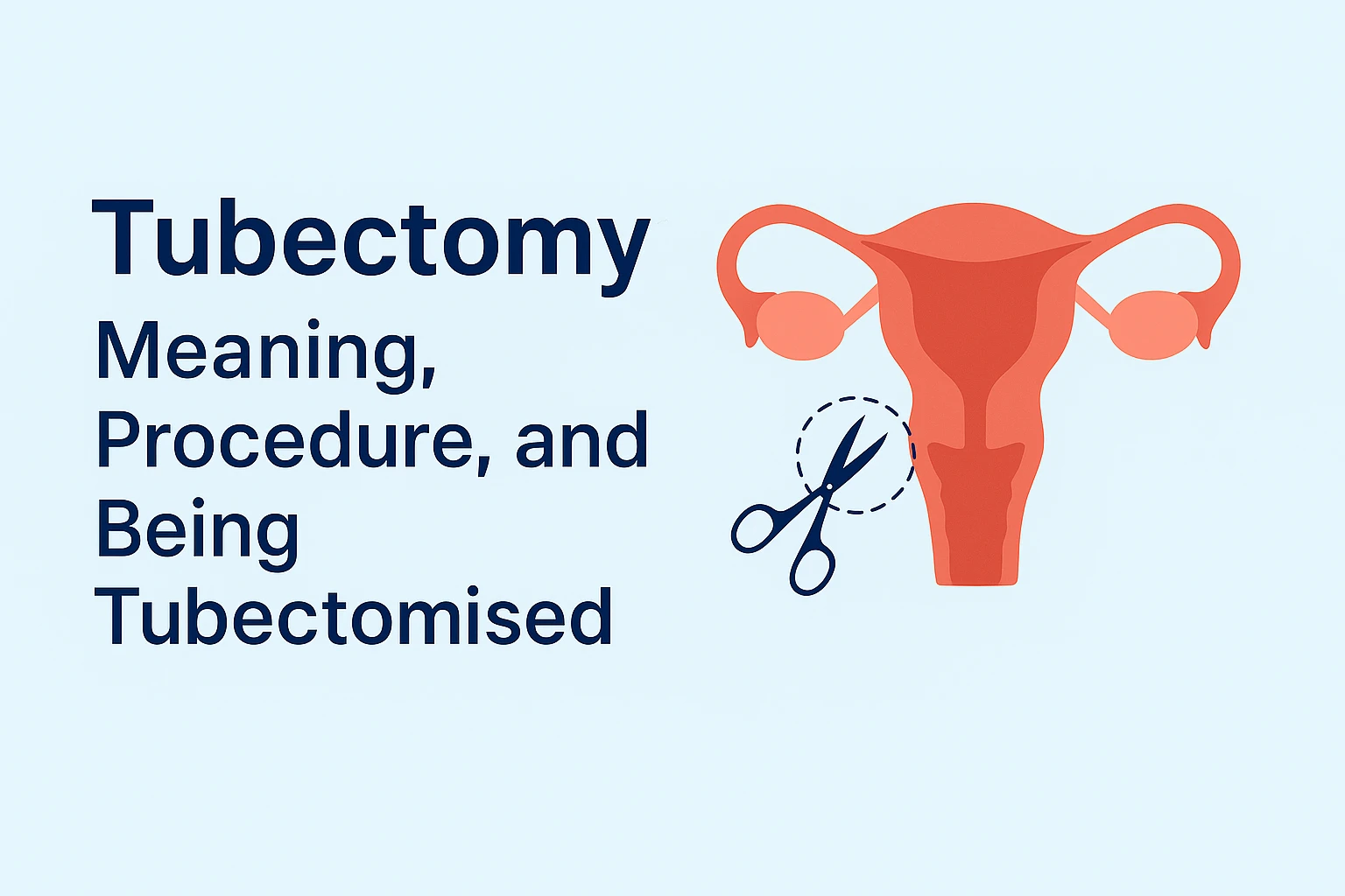 Tubectomy: Meaning, Procedure & What It Means to Be Tubectomised